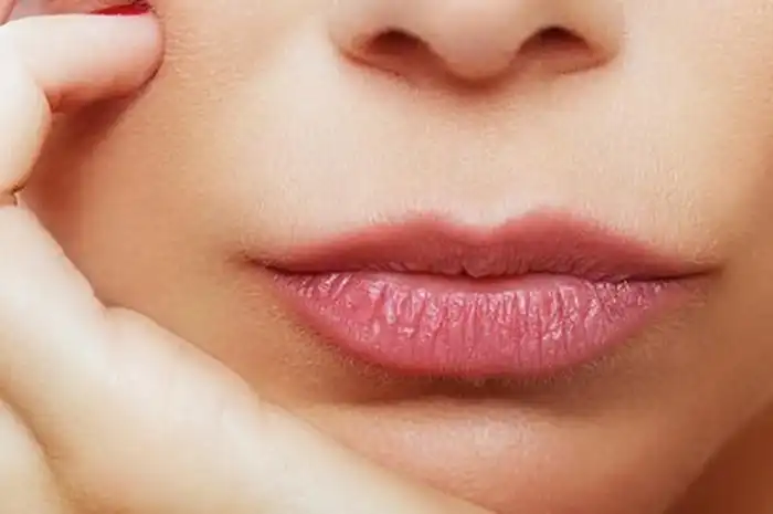 Faktor Penyebab Bibir Kering dan Pecah-Pecah Serta Cara Mengatasinya - Sonora.id