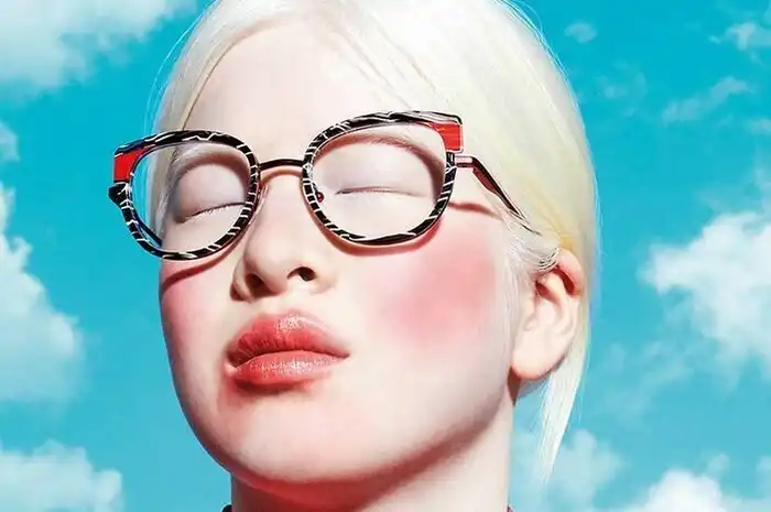 7 Potret Model Albino Xue Li yang Dibuang Orang Tuanya Sendiri - Sonora.id