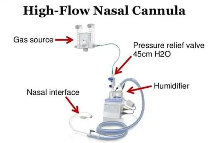 Pasien Covid-19 Gejala Berat Mendapat Terapi Oksigen Aliran Tinggi ...