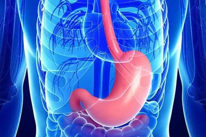 Fakta tentang Asam Lambung yang Jarang Diketahui, Salah Satunya Bisa ...