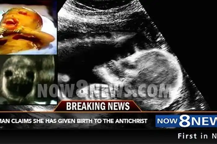 Heboh! Kisah Bayi Setan yang Bisa Bertahan Tanpa Air Ketuban di Dalam ...