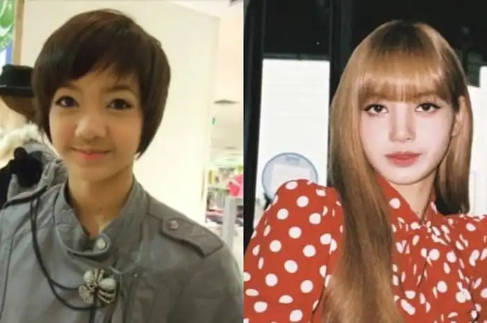 Before After Lisa BLACKPINK: Dugaan Operasi Plastik Terungkap - Sonora.id