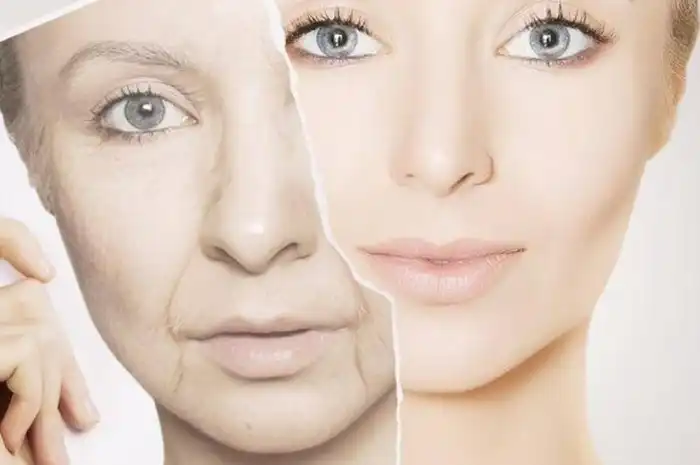 Cara Mengatasi Mata Sayu Agar Dapat Terlihat Lebih Segar dan Sehat ...