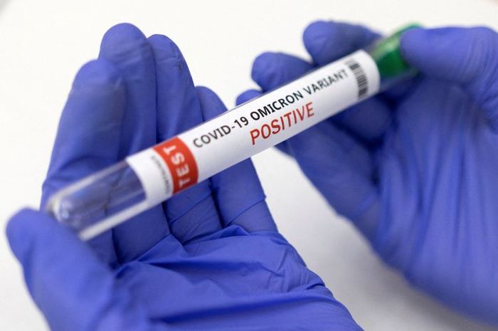 Kamu Positif Omicron? Begini 8 Cara Dapat Obat Gratis dari Kemenkes ...
