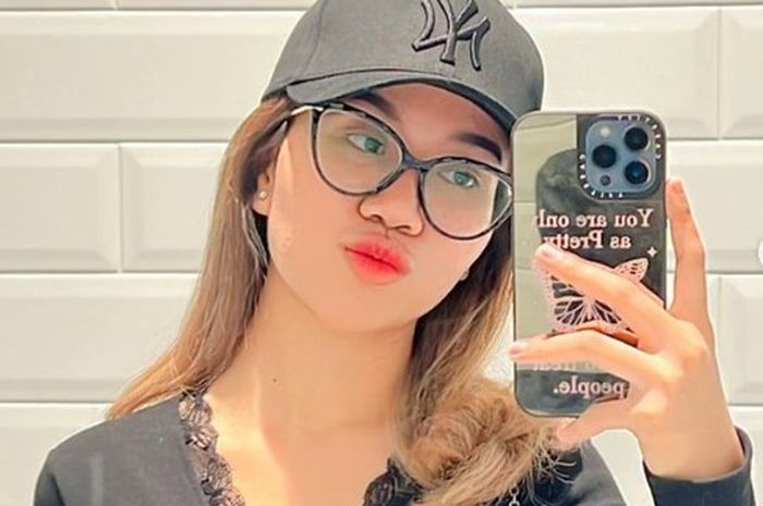 Ngelunjak, Adik Mendiang Vanessa Angel Ngebet Ubah Bagian Tubuhnya, ‘Aku Agak Lebar’ - Sonora.id