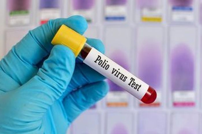 Berikut Sejumlah Lokasi Pelaksanaan Sub PIN Polio di Kota Medan - Sonora.id