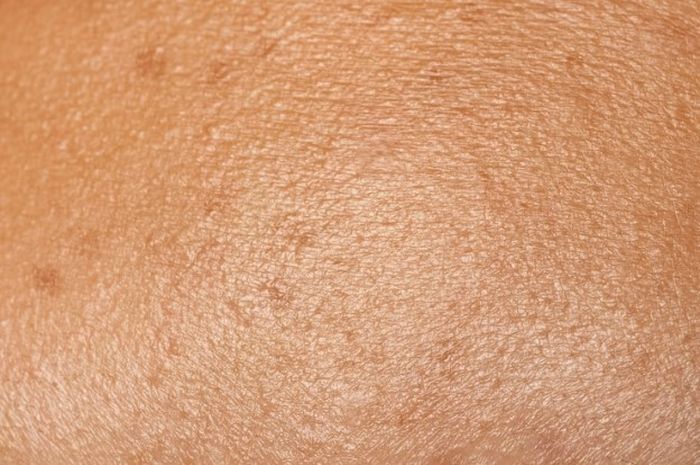11 Cara Menghilangkan Kulit Bertekstur, Coba Agar Kulit Kembali Sehat ...