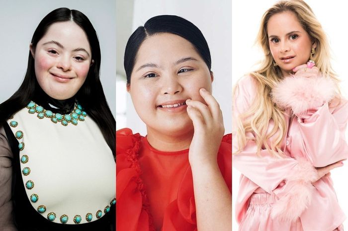 Inspiratif di Industri Modeling, Inilah Deretan Model Down Syndrome ...