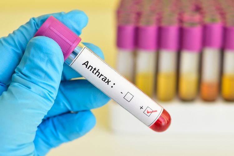 Warga Meninggal Usai Makan Daging Sapi, Kenali Ciri dan Gejala Antraks ...