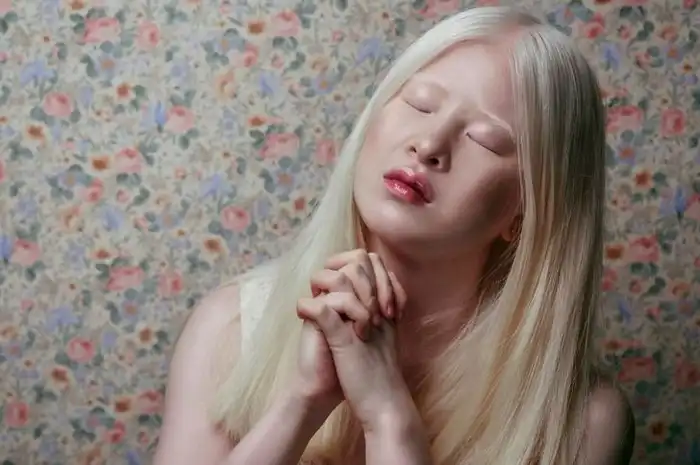 Xueli, Gadis Albino yang Sempat Dibuang dan Kini Jadi Model Vogue ...